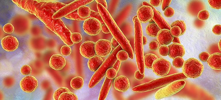 Mycoplasma Test London | Sexual Health Clinic | STI Clinic London