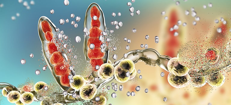 Fungal Infections | Private STD Testing | STI Clinic London